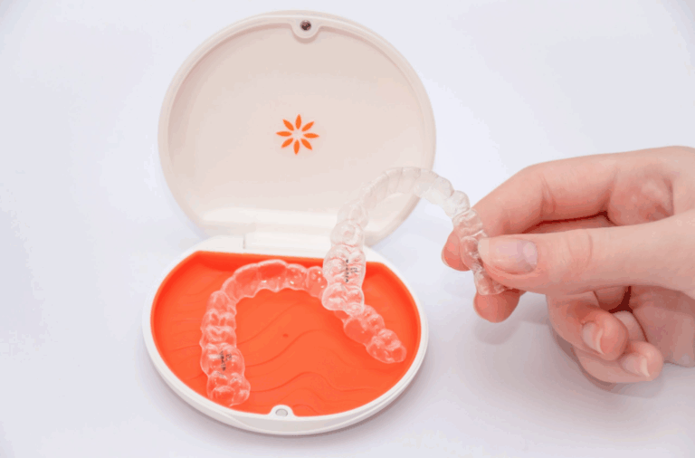 Vivera Retainer - TDH